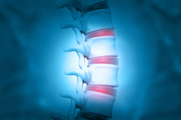 Worms in the Brain: Causes, Symptoms, and Prevention of Neurocysticercosis